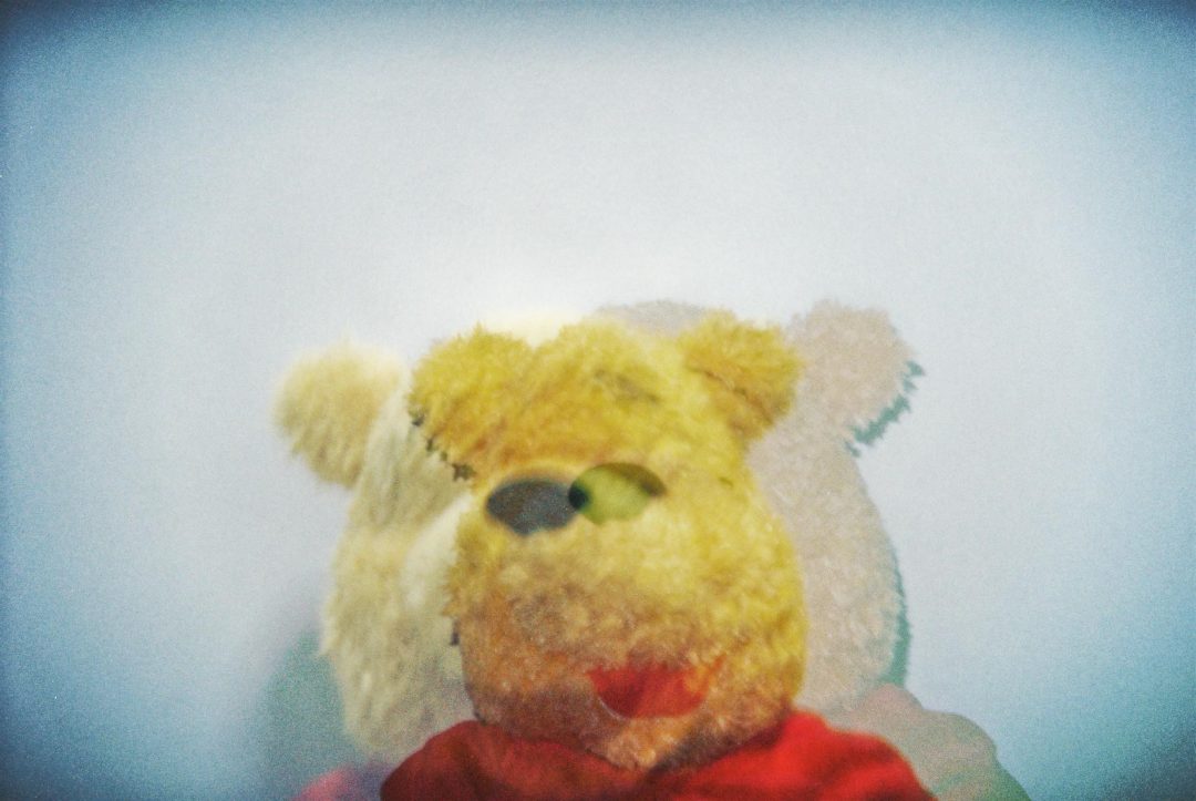 Convergence insufficiency | Optometrist - Glasses - Spectacles ...